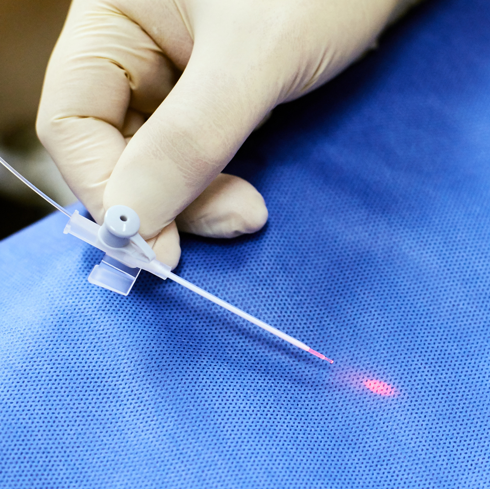 Lasers in medicine: a leap into the future of treatment - Metrum Cryoflex